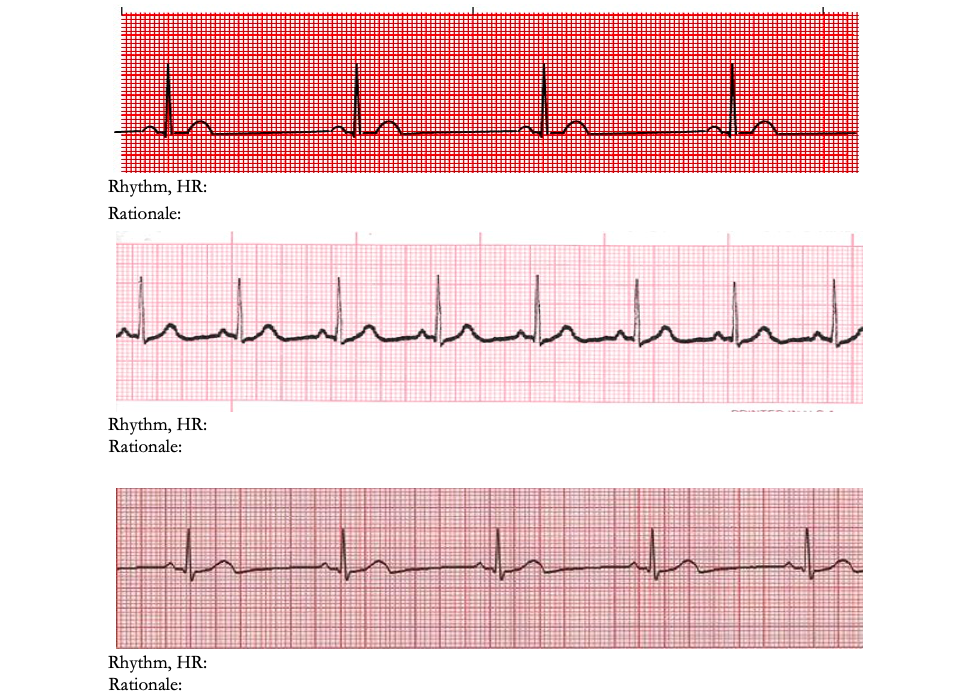 Identify the following rhythm and heart rate and | Chegg.com