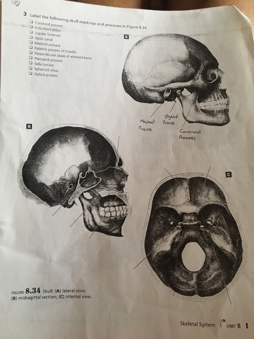 Coronoid Process Skull