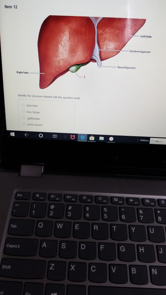 Solved Item 12 Left lobe Falciform ligament Round ligament | Chegg.com
