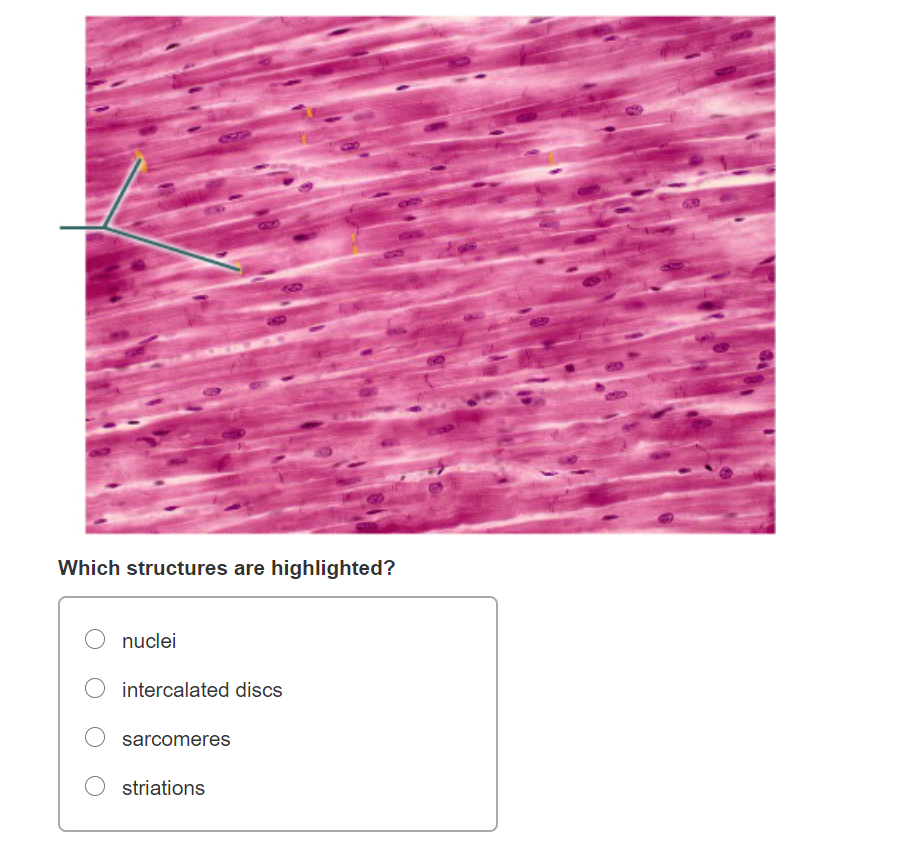 Solved Which structures are highlighted? O nuclei | Chegg.com