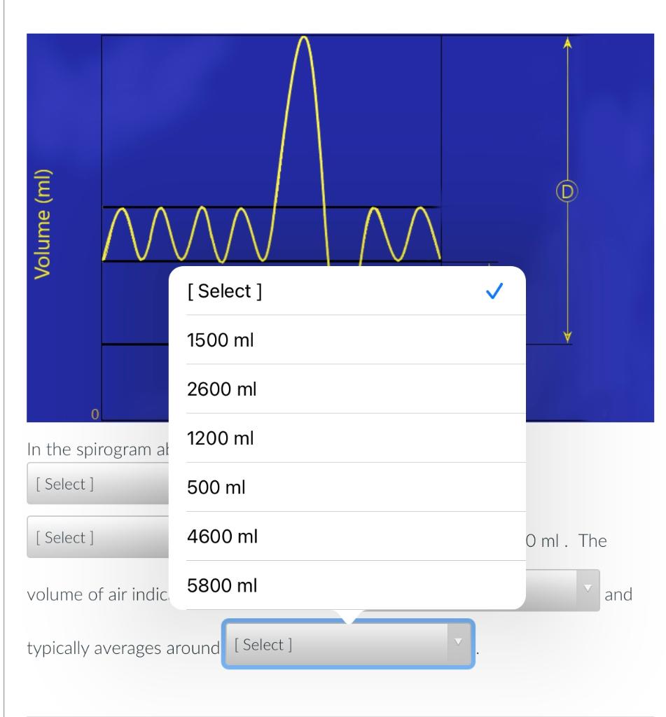 Solved Volume (ml) MW m In the spirogram above, the volume | Chegg.com