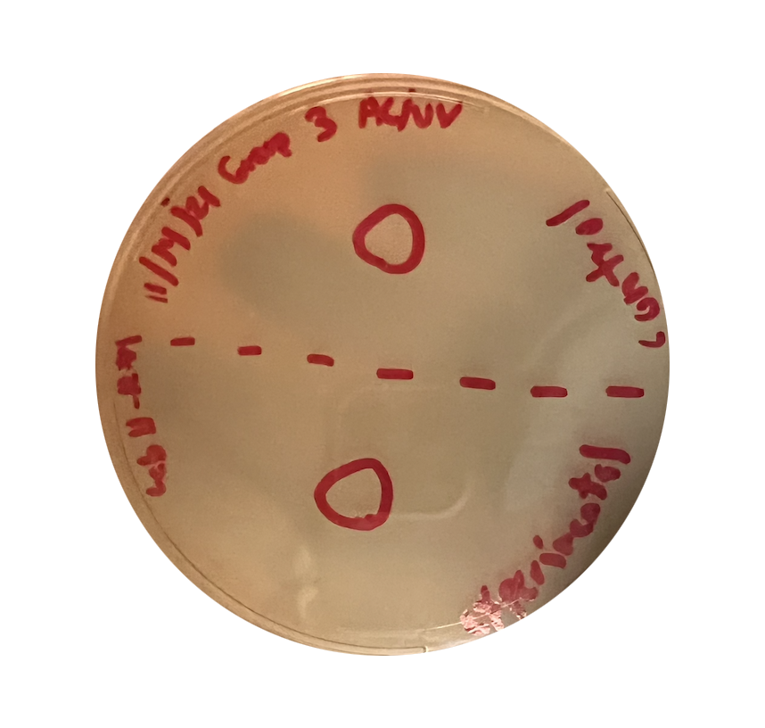 Solved What does it mean if the bacteria partially stained | Chegg.com