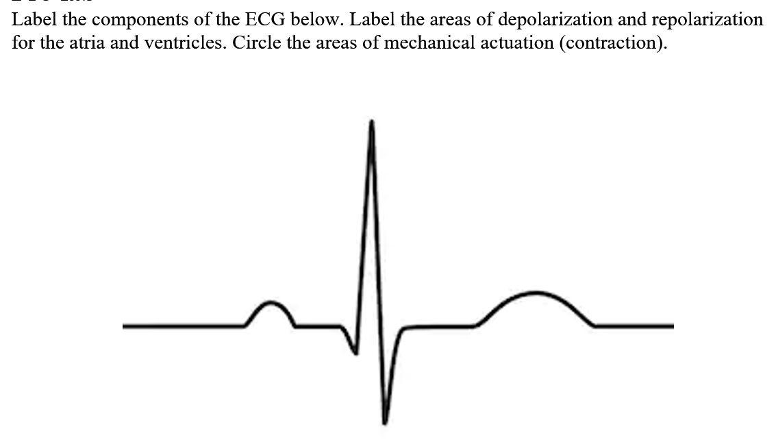 Solved Label the components of the ECG below. Label the | Chegg.com