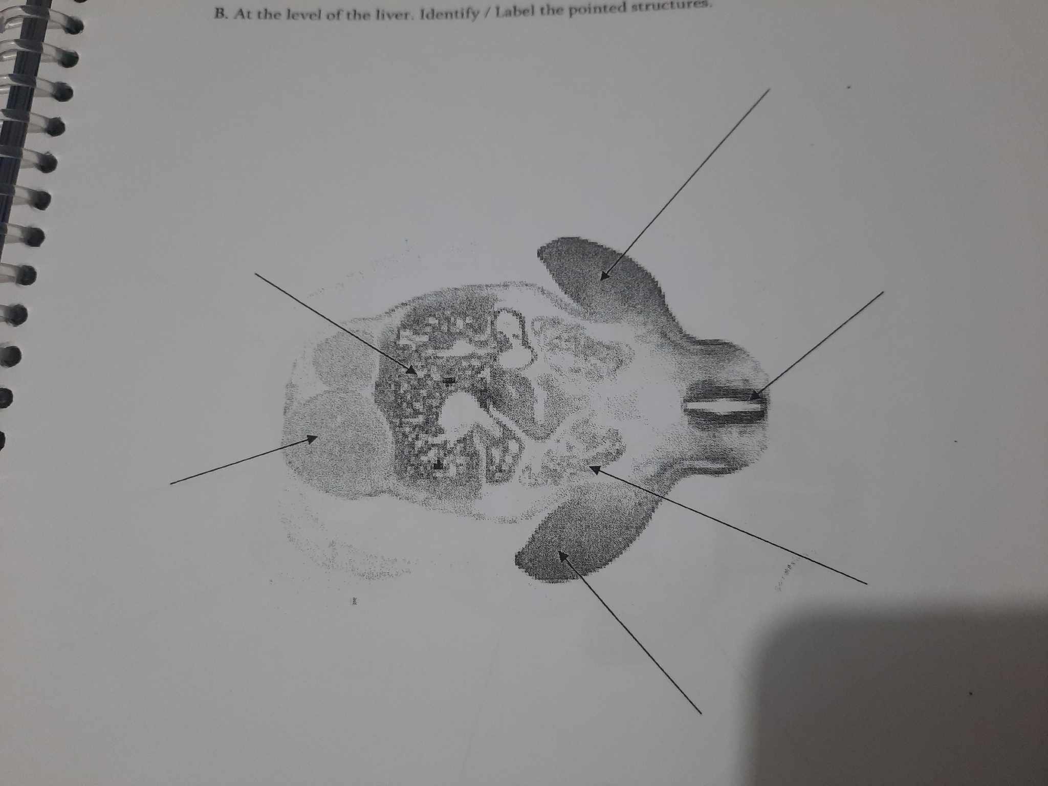 Solved B. At the level of the liver. Identify / Label the | Chegg.com