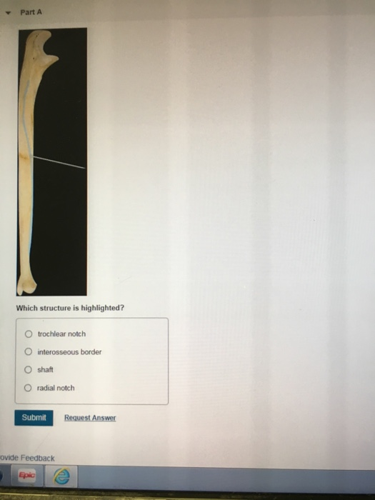 Solved Part A Which structure is highlighted? O trochlear | Chegg.com