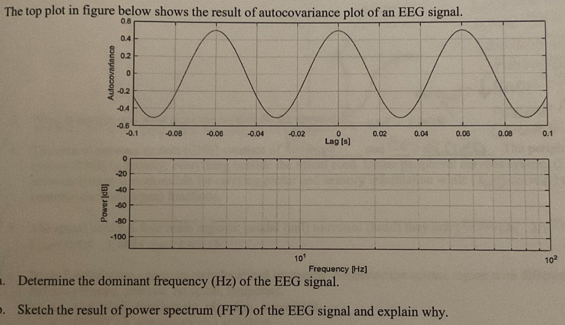 Determine the dominant frequency (Hz) of the EEG | Chegg.com