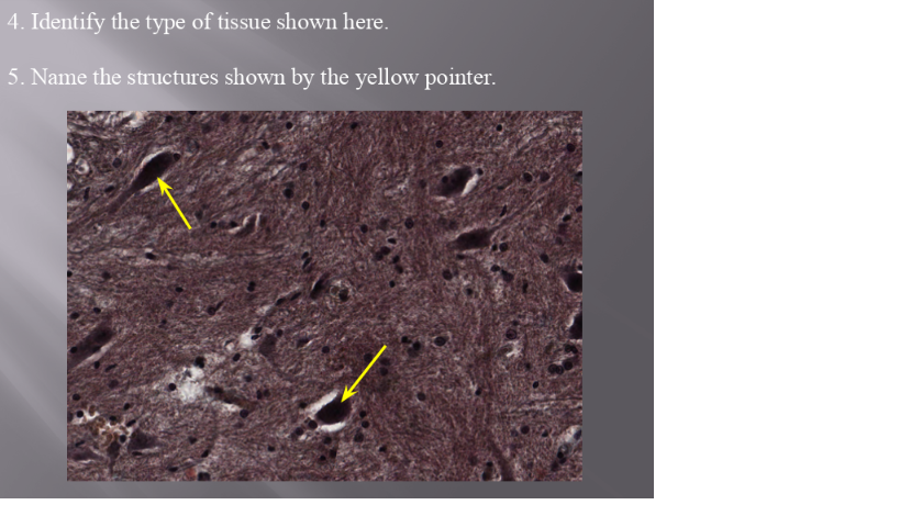 Solved 4. Identify the type of tissue shown here. 5. Name | Chegg.com