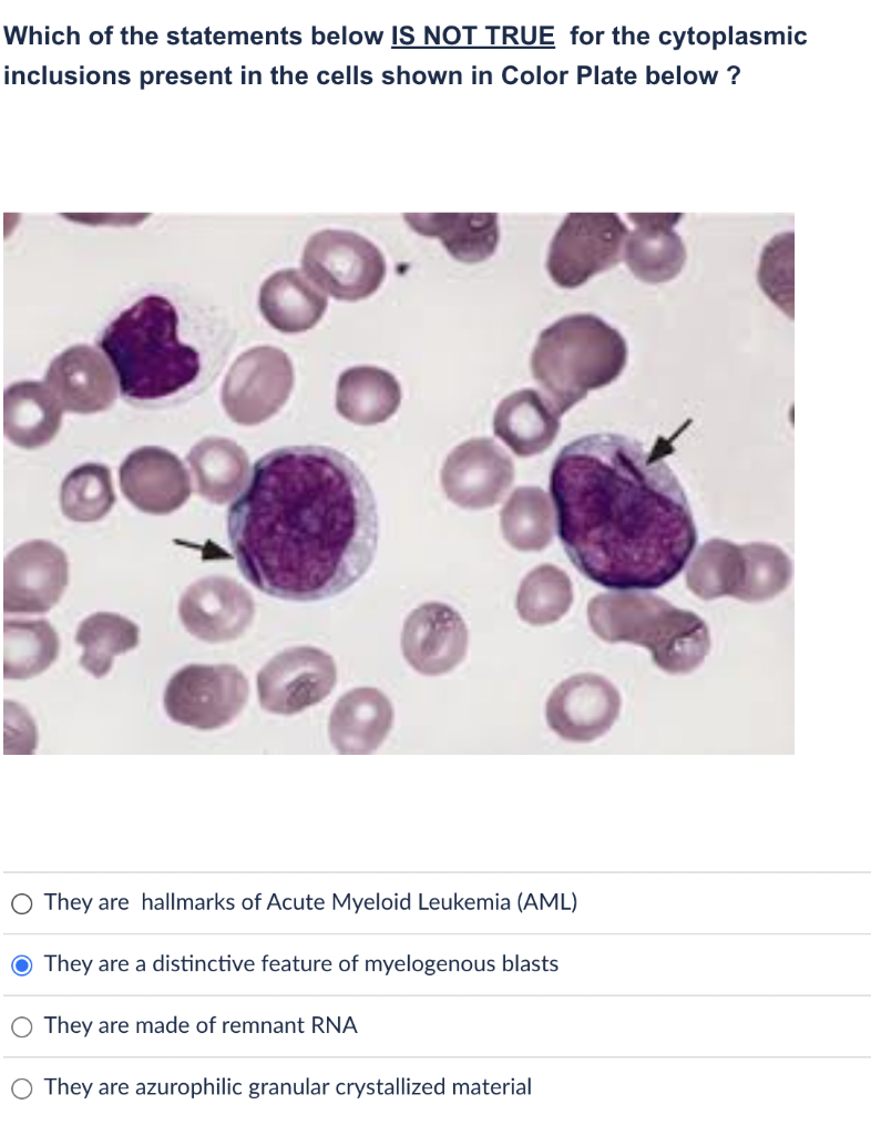 Solved Which of the statements below IS NOT TRUE for the | Chegg.com