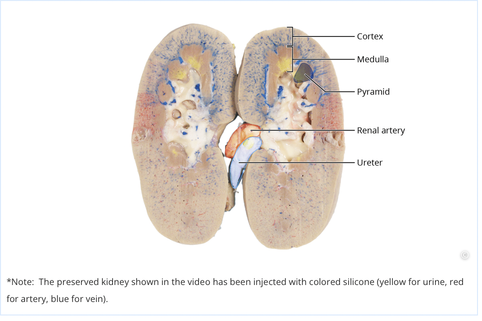 Solved *Note: The preserved kidney shown in the video has | Chegg.com