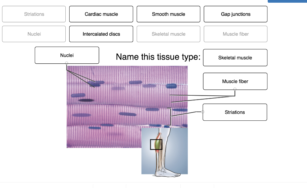 Solved Vlew previous atten Simple Simple squamous | Chegg.com