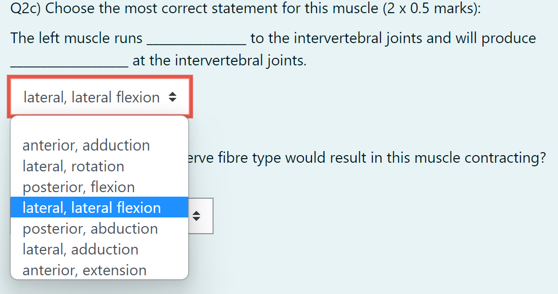 Solved Q2c) Choose the most correct statement for this | Chegg.com