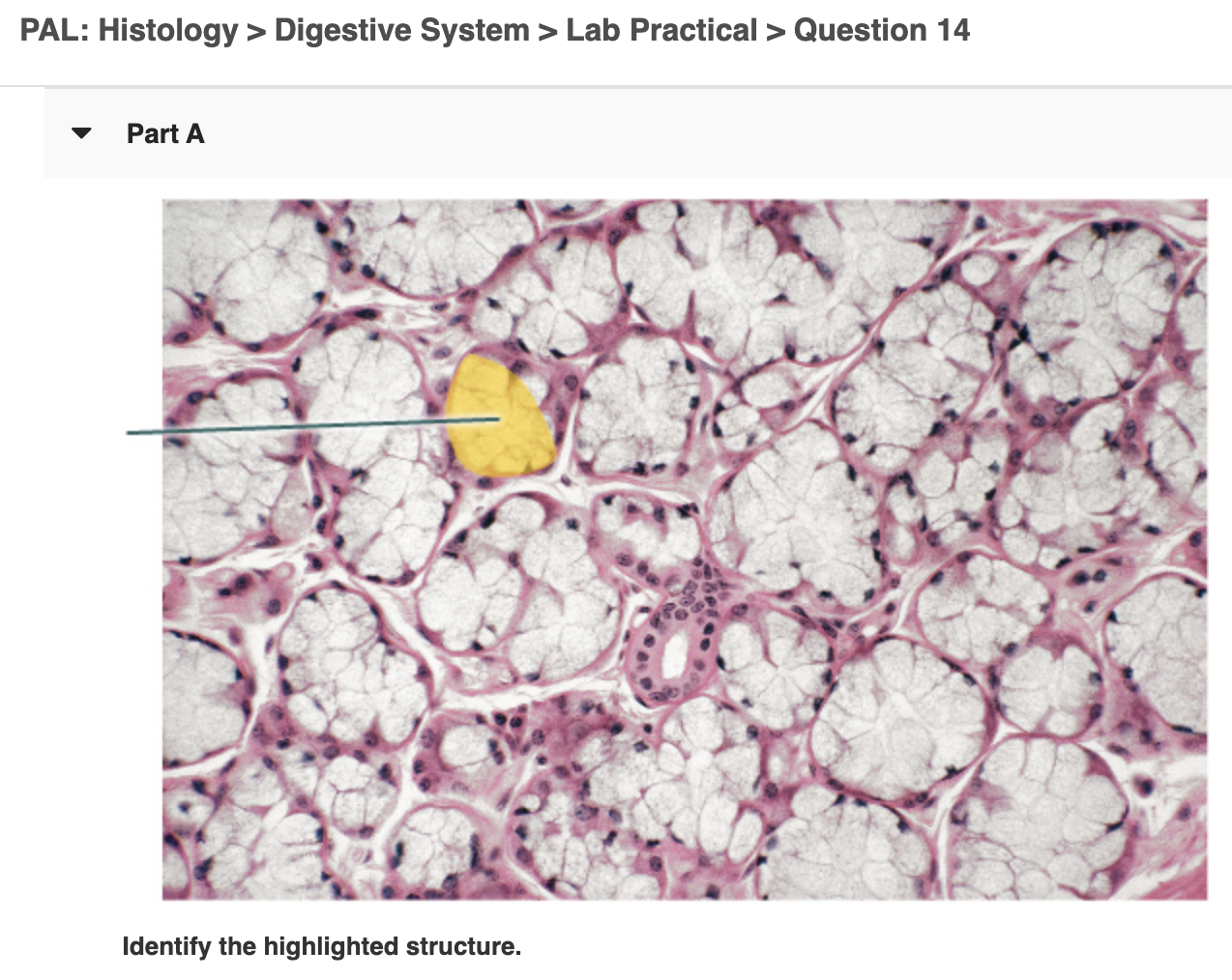 Solved PAL: Histology > Digestive System > Lab Practical > | Chegg.com