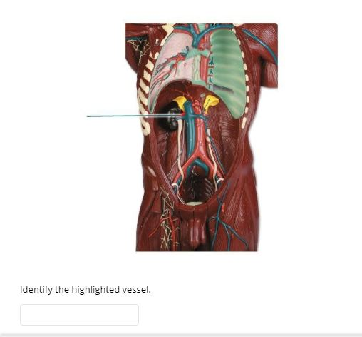 Solved Identify the highlighted vessel Identify the | Chegg.com