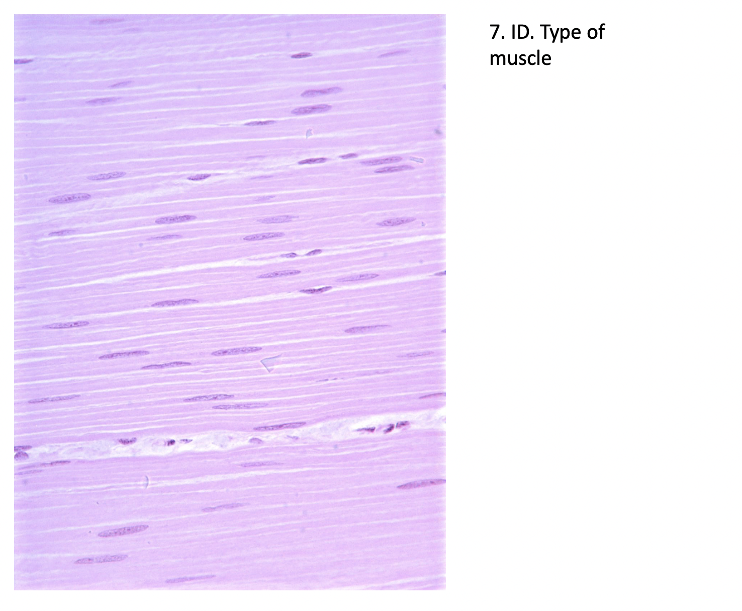 Solved 7. ID. Type of muscle | Chegg.com