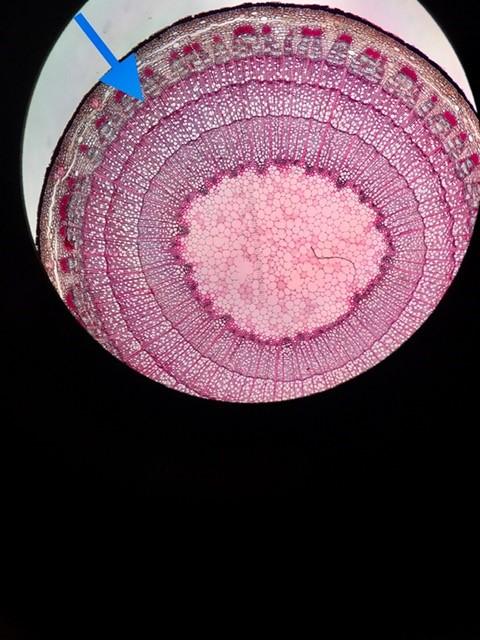 Solved 1.) Medicago (Alfalfa) stem, 100x mag., showing | Chegg.com