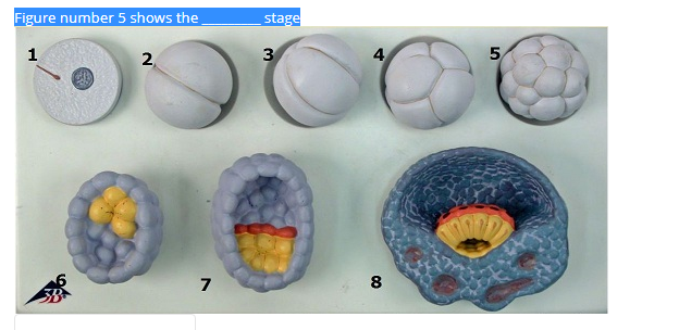 Solved Figure number 5 shows the. stage | Chegg.com