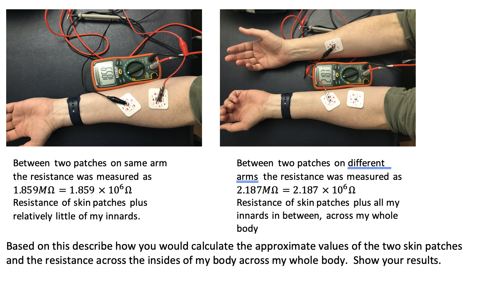 Solved 690 2011 Between two patches on same arm Between two | Chegg.com