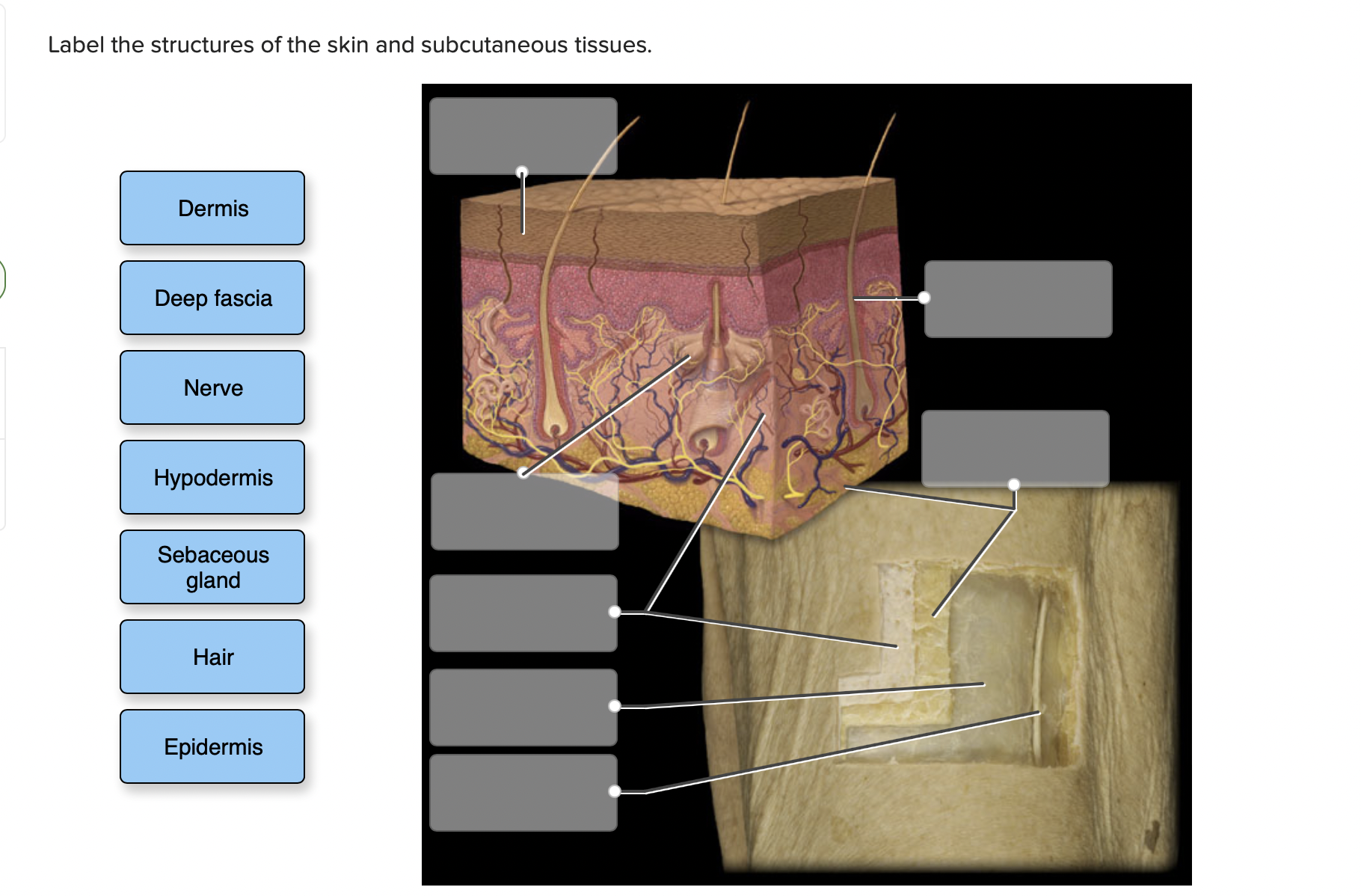 Solved Label the structures of the skin and subcutaneous | Chegg.com