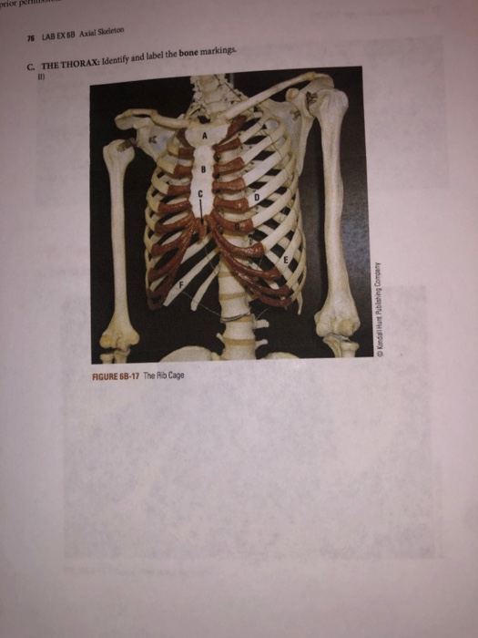 Solved R. Complete this table describing bone classification | Chegg.com