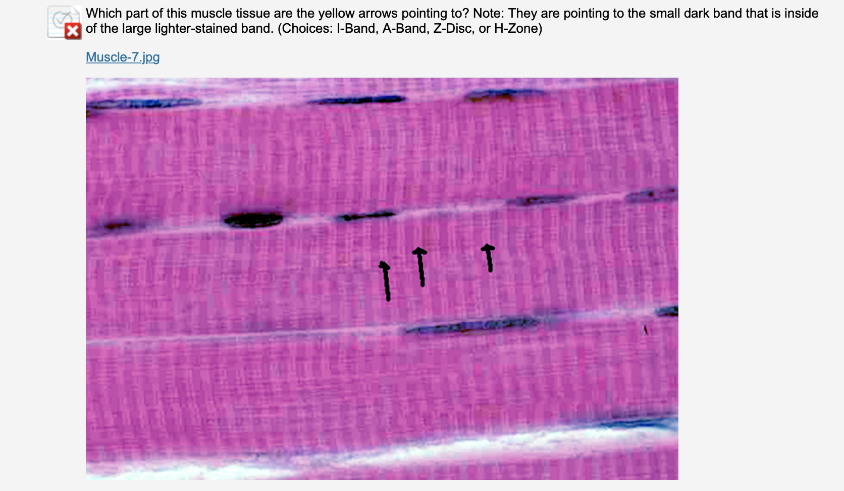 Solved Which part of this muscle tissue are the yellow | Chegg.com