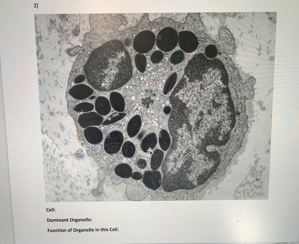 Solved Cells: Eosinophil Lymphocyte Cardiac Muscle Leaf Cell | Chegg.com