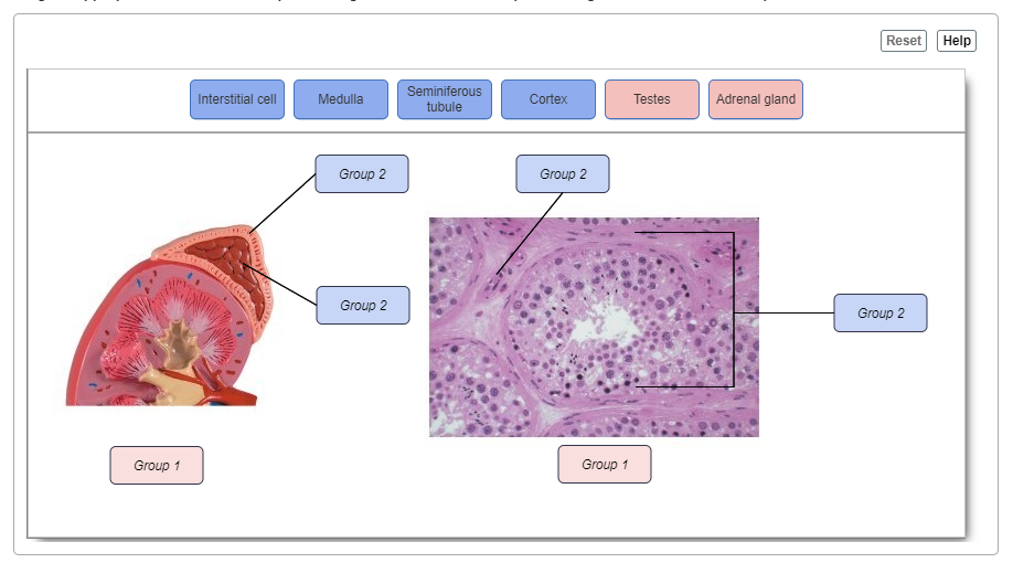Solved Reset Help Interstitial cell Medulla Seminiferous | Chegg.com