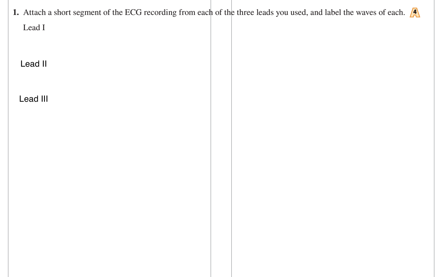 Solved 1. Attach a short segment of the ECG recording from | Chegg.com