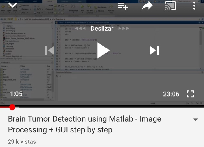 Solved Deslizar i4 1:05 23:06 T Brain Tumor Detection using | Chegg.com