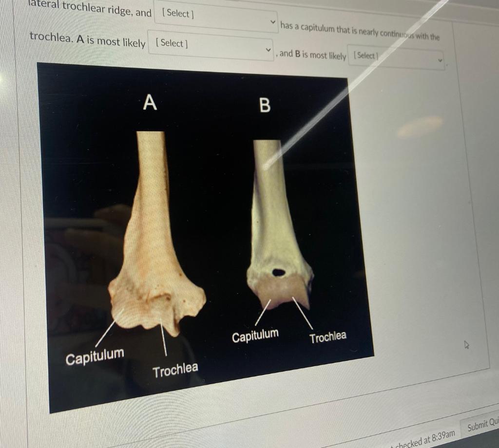 Solved Question 11 3 pts The trochlea is the structure on | Chegg.com