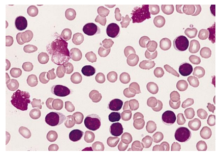 Solved 70 year-old male patient visits family physician for | Chegg.com