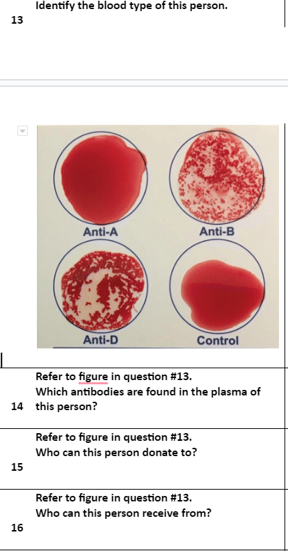 Solved Identify the blood type of this person. 13 | Chegg.com