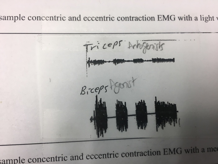 Solved sample concentric and eccentric contraction EMG with | Chegg.com