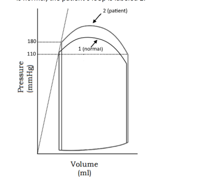 Solved 11 is the normal PVL loop and 2 refers to the patent | Chegg.com