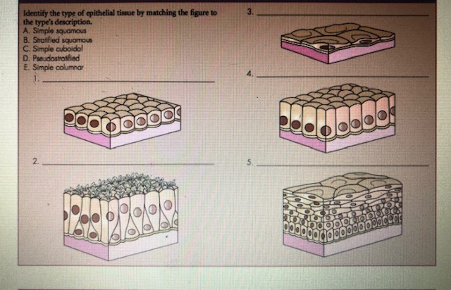 Solved 3. Identify the type of epithelial tissue by matching | Chegg.com