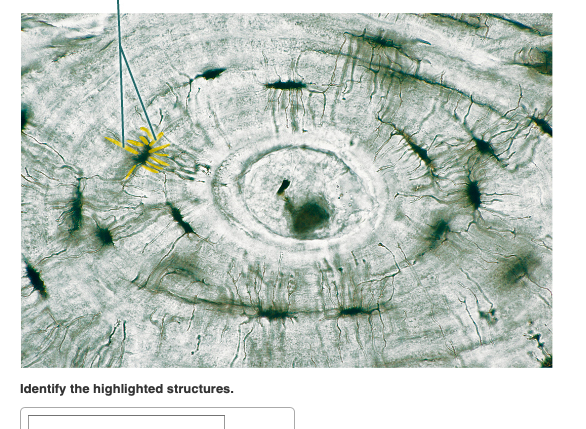Solved Identify the highlighted structures. | Chegg.com
