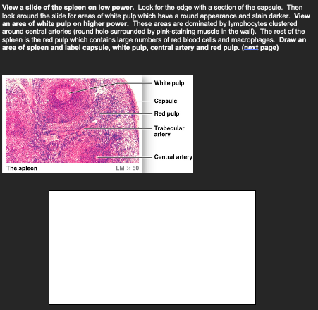 Solved View a slide of a lymph node on low power. (Slides | Chegg.com