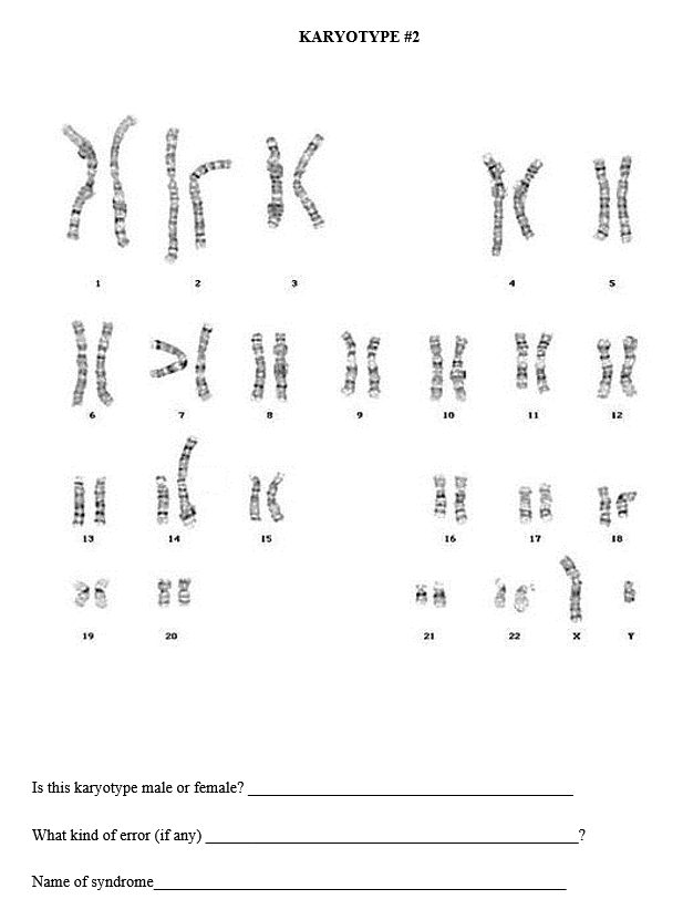 Solved KARYOTYPE \#2 Is this karyotype male or female? What | Chegg.com