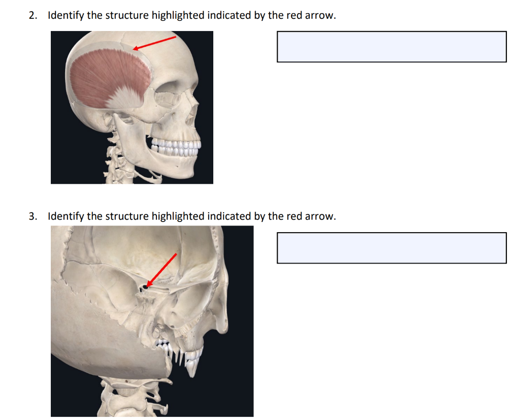 Solved 2. Identify the structure highlighted indicated by | Chegg.com