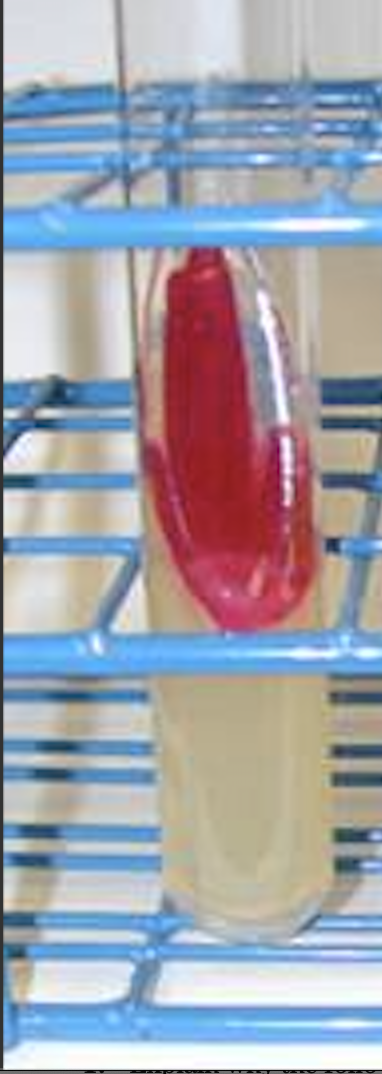 ervations and Results Nutrient Broth Nutrient Agar | Chegg.com