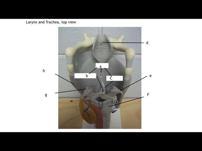 Solved Larynx and Trachea, top view | Chegg.com
