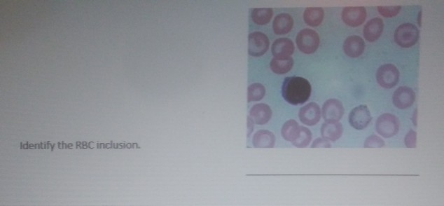 Solved DO 90000 Identify the RBC inclusion | Chegg.com