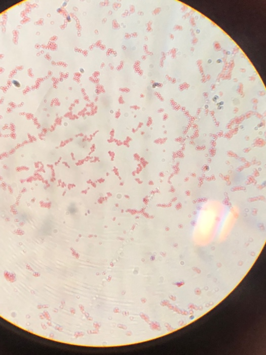 Solved Help identifying unknown bacteria from this list | Chegg.com