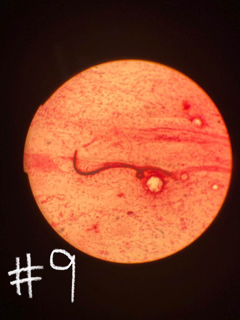 Solved Microscope slide #7 Smear of feces, ordered | Chegg.com
