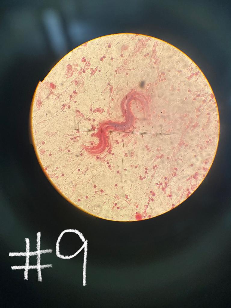 Solved Microscope slide #8 Fecal smear – unspecified stain | Chegg.com
