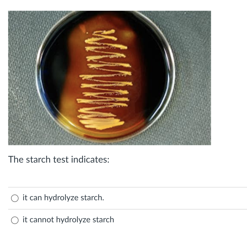 Solved The starch test indicates: it can hydrolyze starch. O | Chegg.com