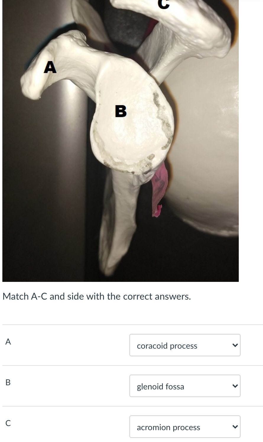 Solved A B Match A-C and side with the correct answers. A | Chegg.com