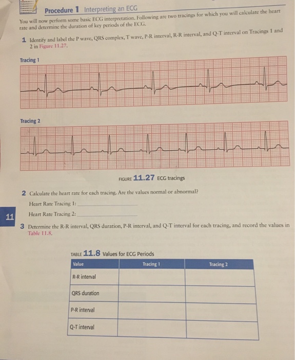 Solved You will now perform some basic ECG interpretation. | Chegg.com