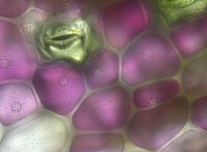 Solved Circle a Leucoplast | Chegg.com