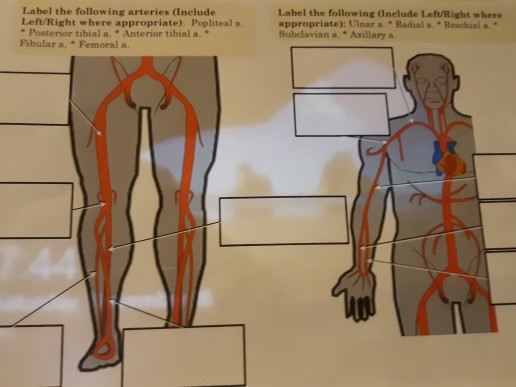 Solved Label the following arteries (Include Left/Right | Chegg.com