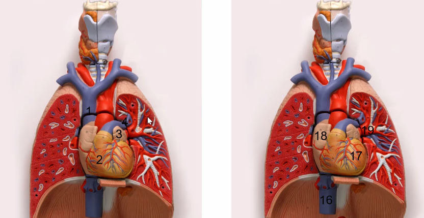 Solved 3B Heart & Lung Model Aorta Pulmonary artery | Chegg.com